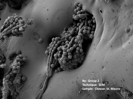 Microbial Food Landscapes | Foodiggity